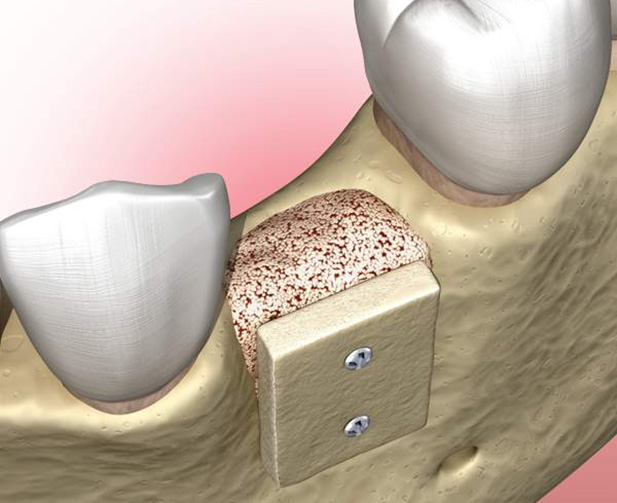 Oral Surgeon Dublin OH | Columbus Oral & Maxillofacial Surgery